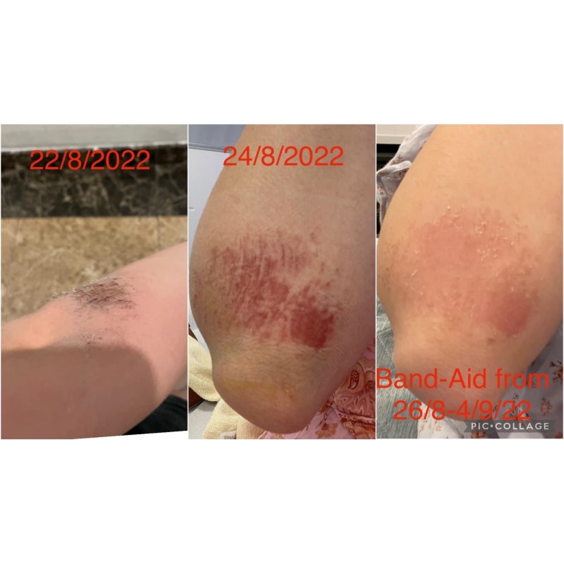 Băng Dán Vết Thương Band-Aid Advanced Healing Hydro Seal Jumbo 3 Miếng ...